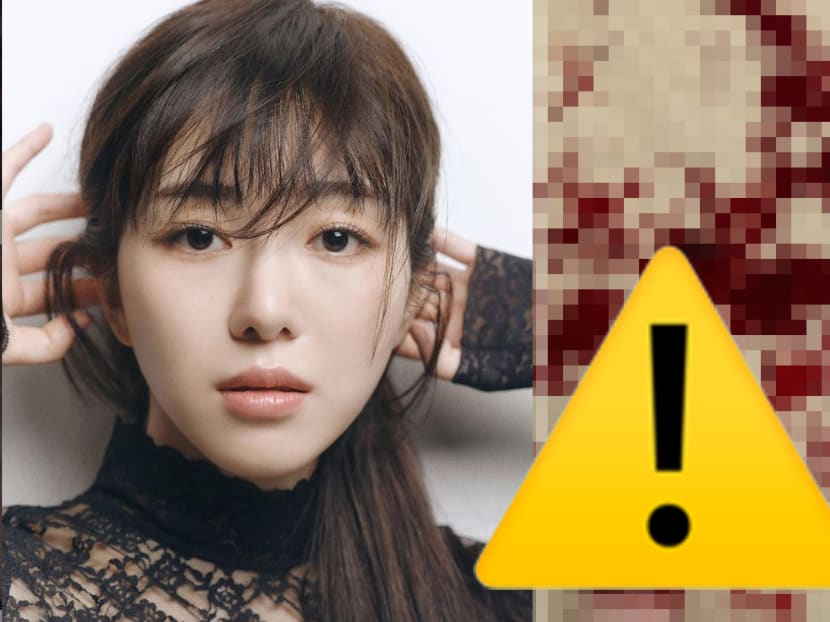 Ex Korean Pop Idol Kwon Mina Posts Graphic Pic Of Bleeding Wrist, Says ...