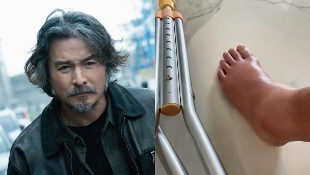 Actor Christopher Lee will miss the Golden Bell Awards ceremony in Taiwan because of a foot ...