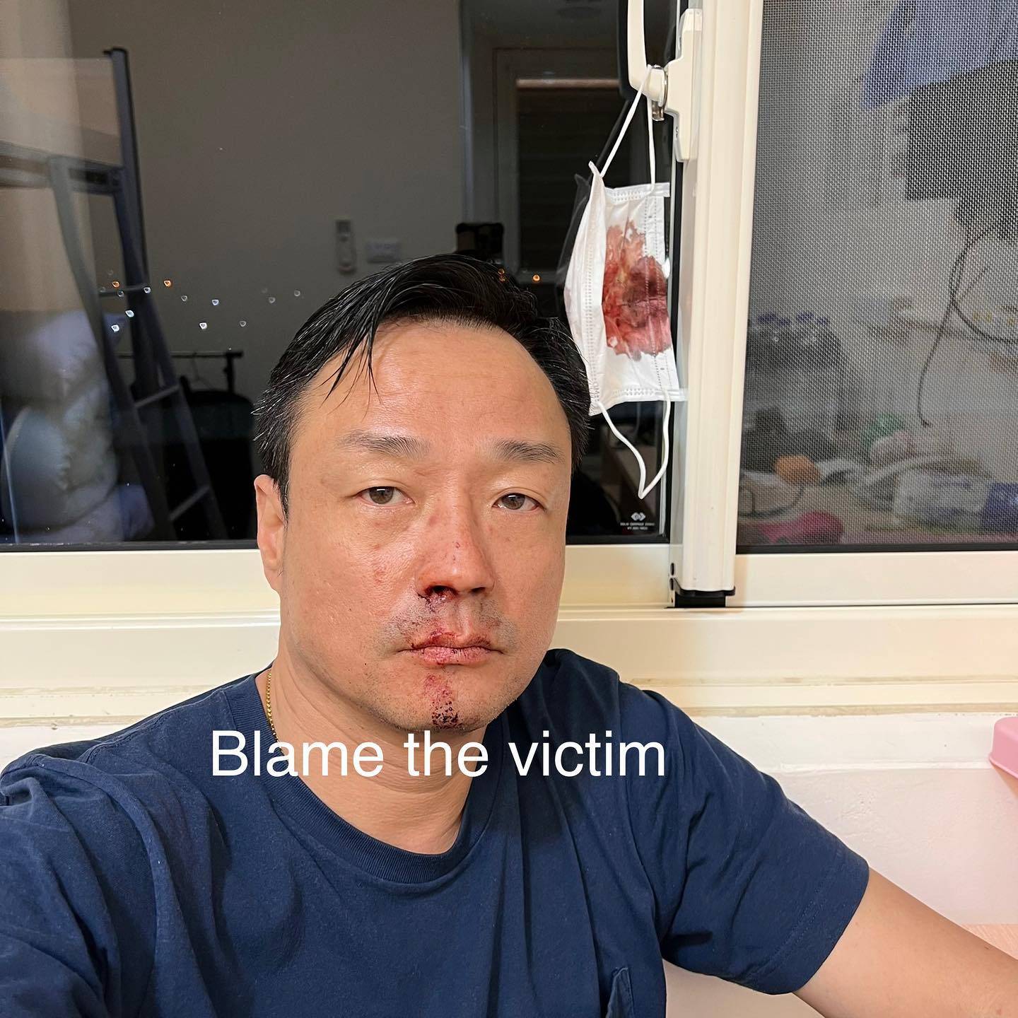 HK Actor Wong Hei Suffers Horrifying Nosebleed After Getting “Stabbed ...