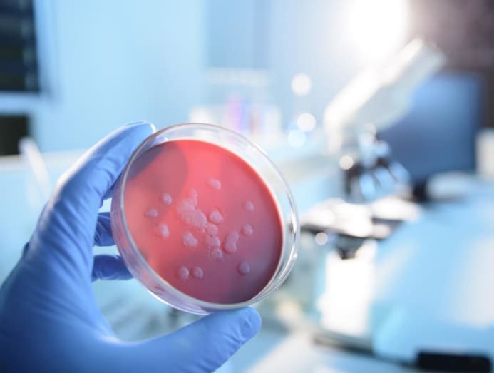 How bacterial infection may lead to sepsis and limb amputation - CNA ...