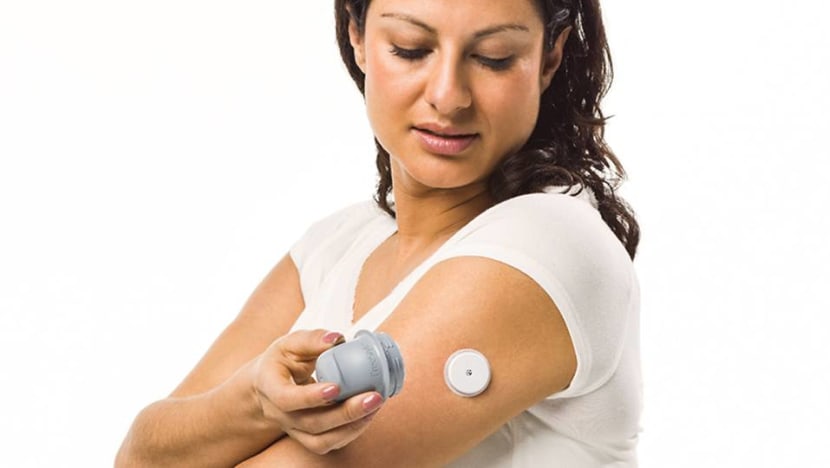 Device to keep tabs on blood sugar levels without finger-pricking ...