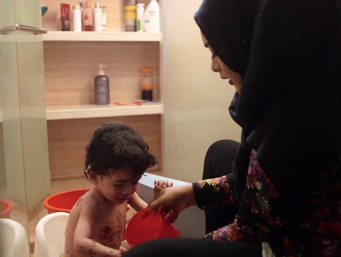 Singapore’s butterfly children, born with ‘the worst disease you’ve ...