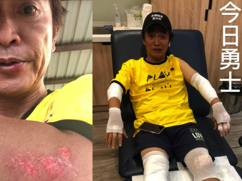 Jacky Wu Crashes Bike While Filming Variety Show; Says His Helmet Was ...