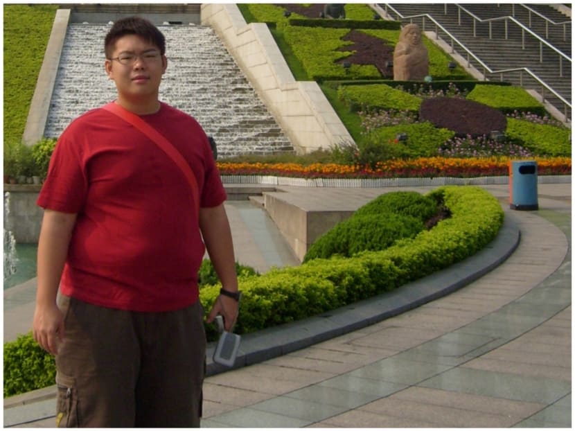 [Bui Zai To Shan Zai!?!?!?] This 34-year-old underwent surgery to shed ...