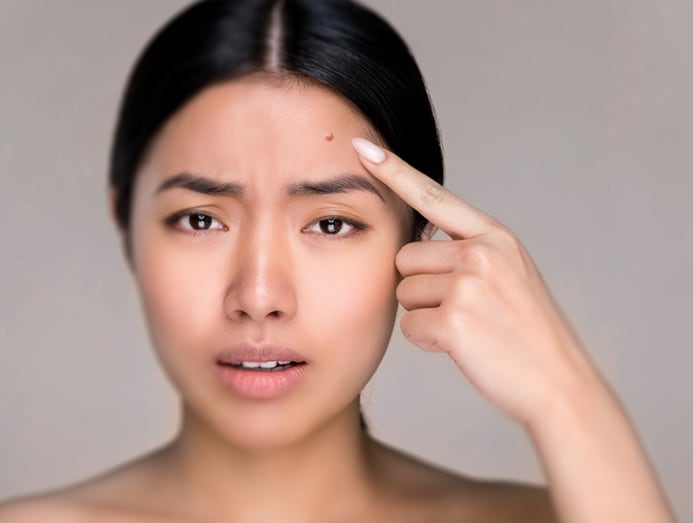 How to safely use retinol for youthful skin: Tips and recommendations ...