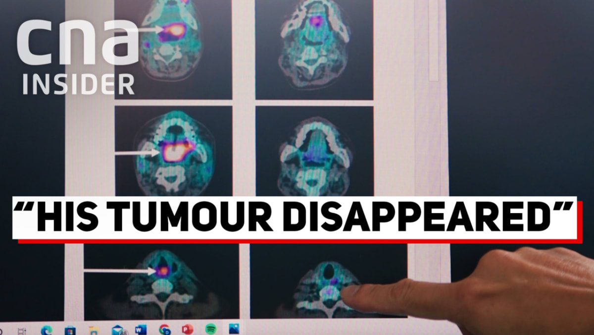 How personalised medicine improves cancer treatment - CNA