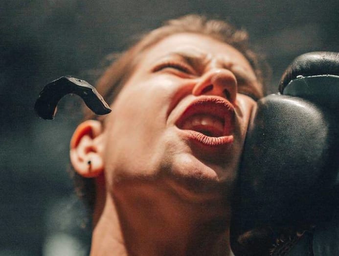 Why do some people get bruises easily – and when should you go see a ...