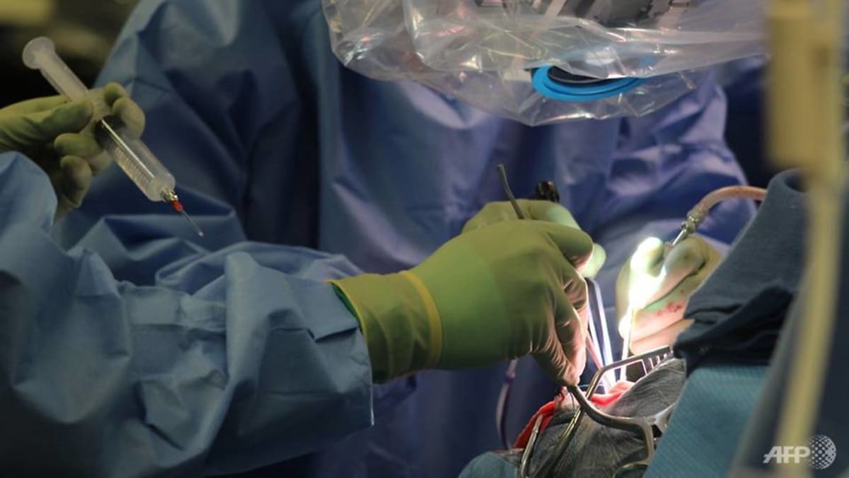 Texas hospital livestreams brain surgery on Facebook - CNA