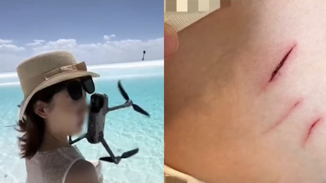 中国女子湖边拍照 遭无人机撞伤脸 - 8world