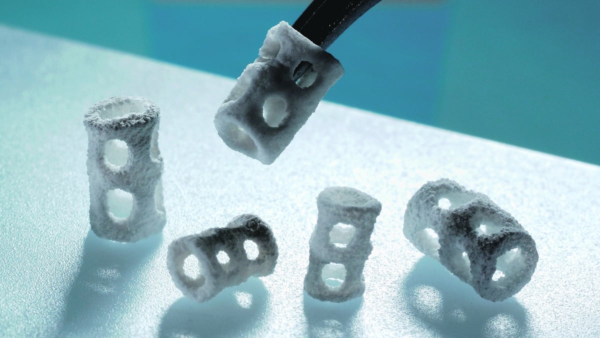 Bone tissue scaffolds make their way into dental clinics - TODAY