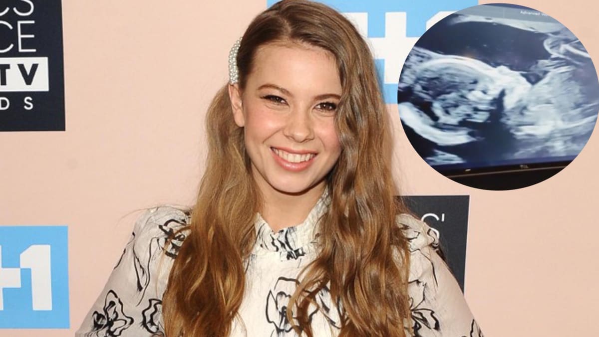 Bindi Irwin Shares Ultrasound Video of Baby Girl: "She's So Beautiful ...