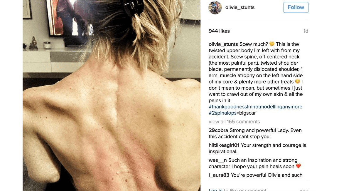 Stuntwoman Olivia Jackson reveals the pain of her on-set accident - 8days