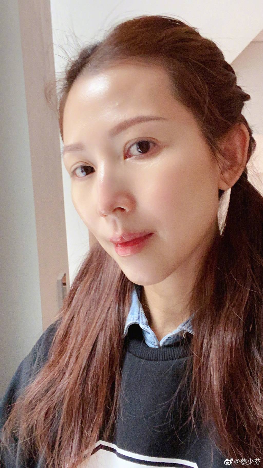 Ada Choi’s Facial Acupuncture Session Is Weirdly Cool… Yet Creepy - 8days