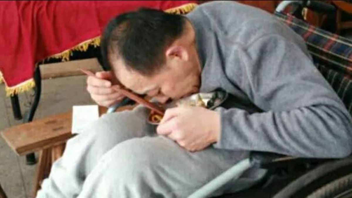 How a mother’s love saw China’s ‘folded man’ through years of pain - TODAY