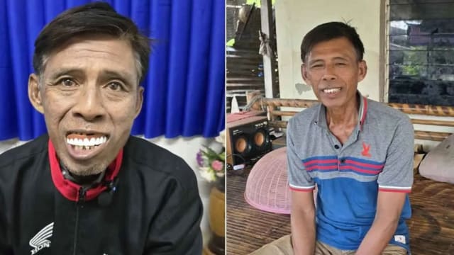 泰阿叔网购假牙 竟收到玩具假牙 - 8world