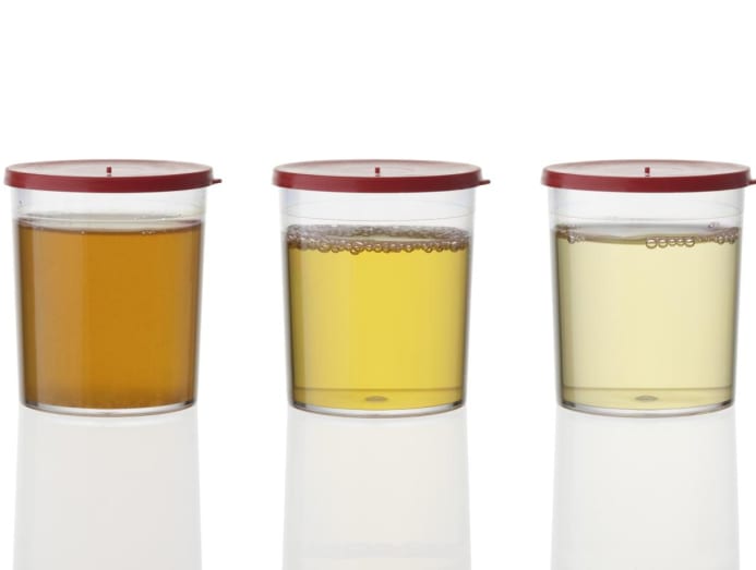 What does the colour of your pee say about your health? - CNA Lifestyle