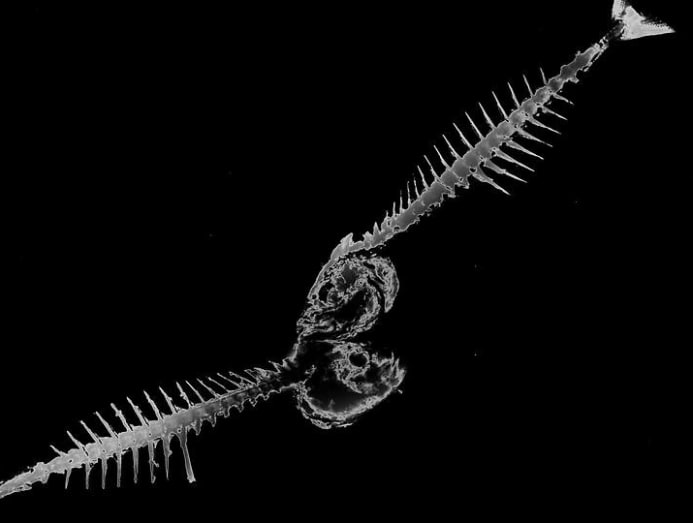 What to do when you've swallowed something you shouldn't have - CNA ...