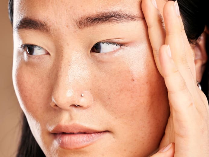 Freckles, sun spots and melasma: What’s the difference and how to keep ...