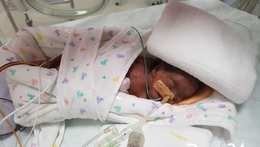 Singapore's smallest premature baby, weighing 345g, beats the odds to ...
