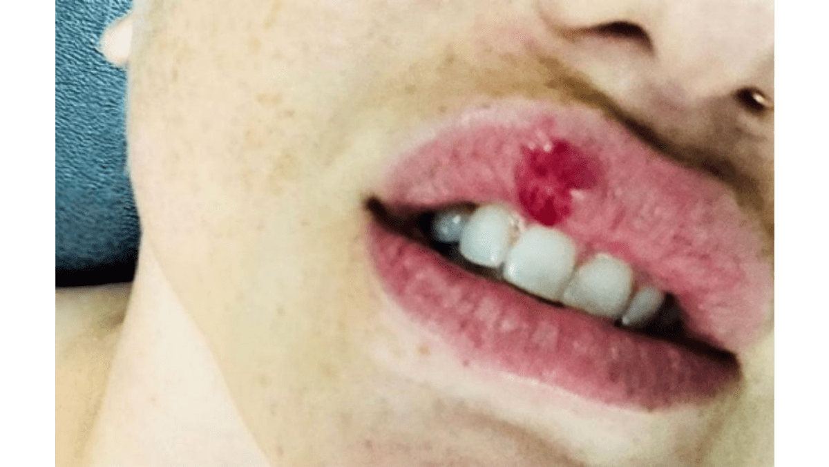 Kesha has busted her lip - 8days