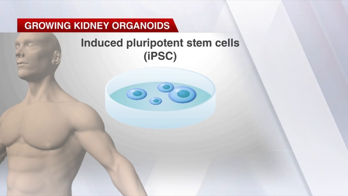 Researchers led by NTU grow mini kidneys using stem cells | Video - CNA