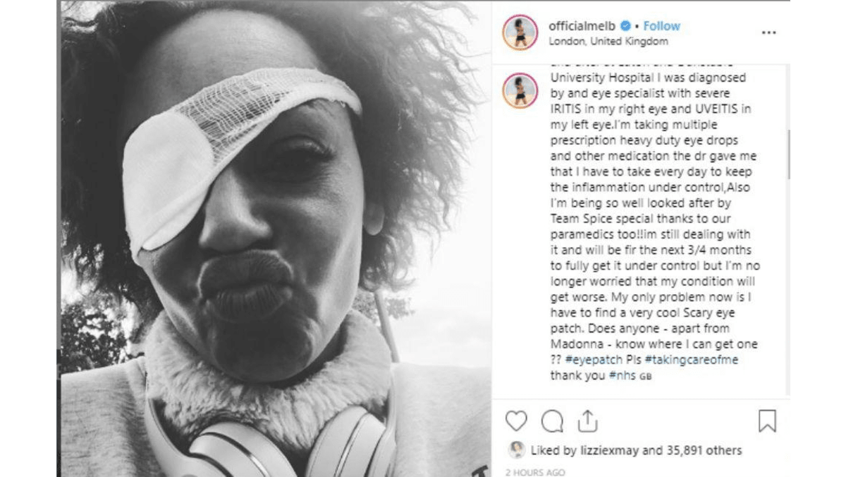 Mel B was 'very very scared' over vision loss - 8days