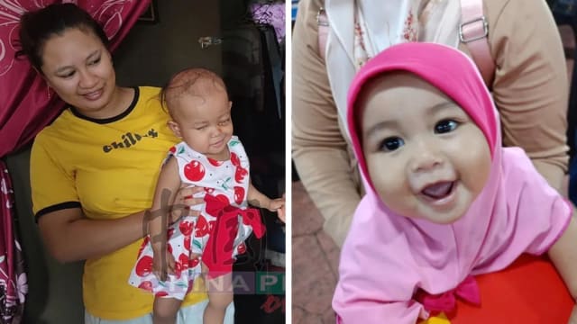 马国女婴罹患眼癌 父母奔波救命口袋只剩20令吉 - 8world