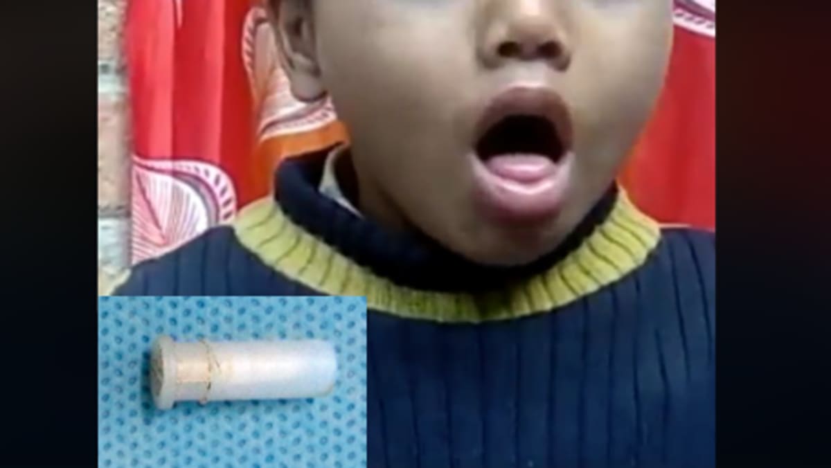 Bunyi batuk kanak-kanak ini seperti wisel. Ternyata... - BERITA Mediacorp