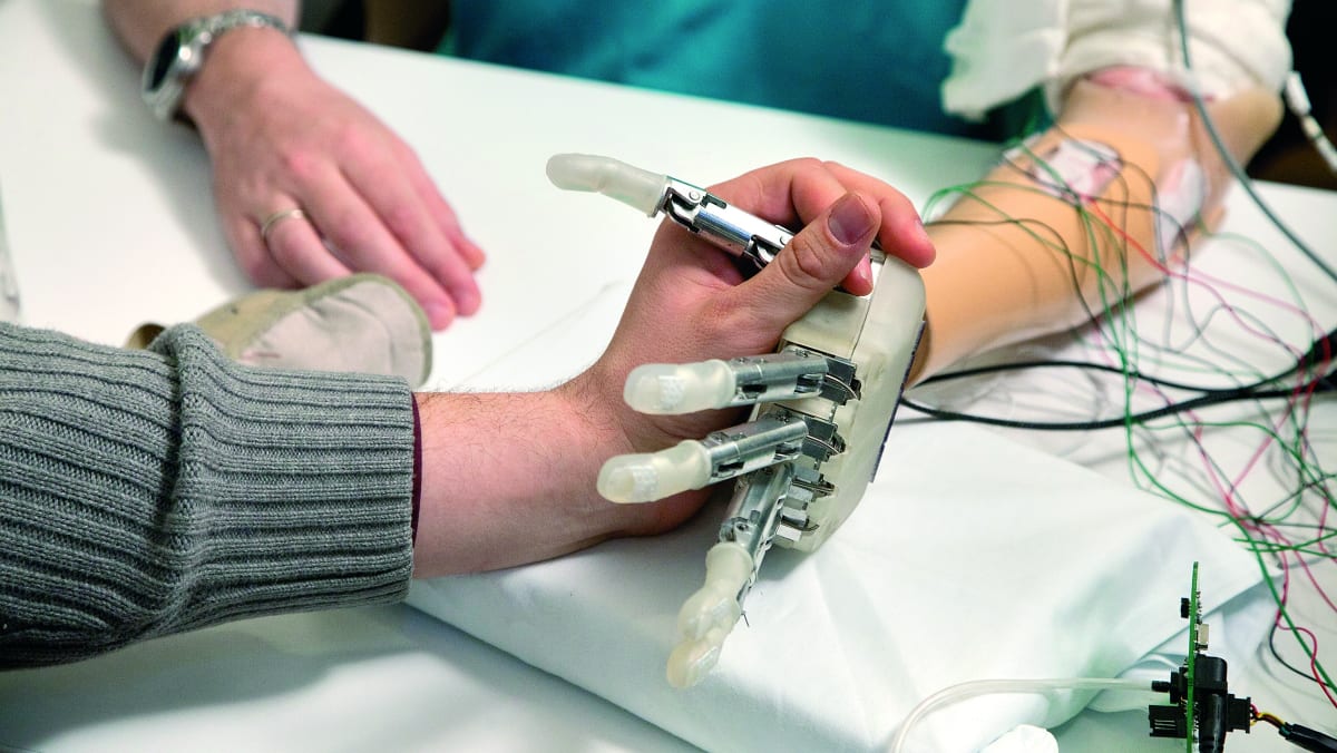 Scientists develop prosthetic hand with sense of touch - TODAY