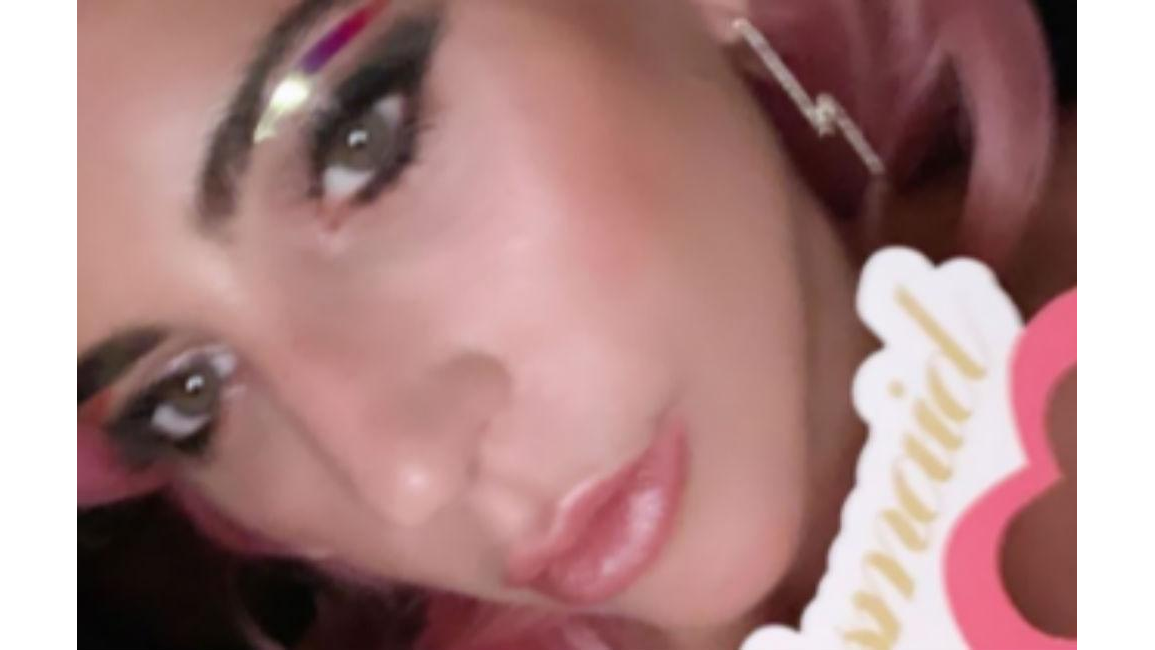 Lady Gaga Is In a Lot Of Pain After Fall 8days lady-gaga-is-in-a-lot-of-pain-after-fall-8days