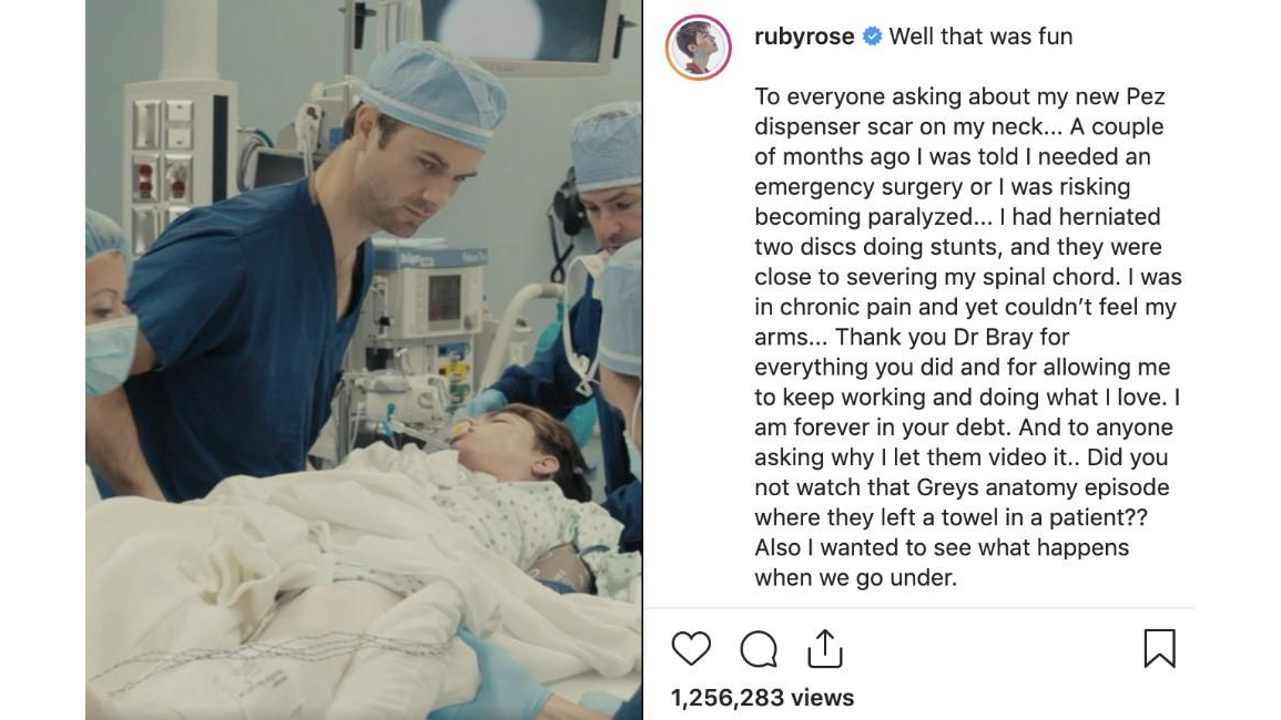 Ruby Rose had 'emergency surgery' following stunt injury - 8days