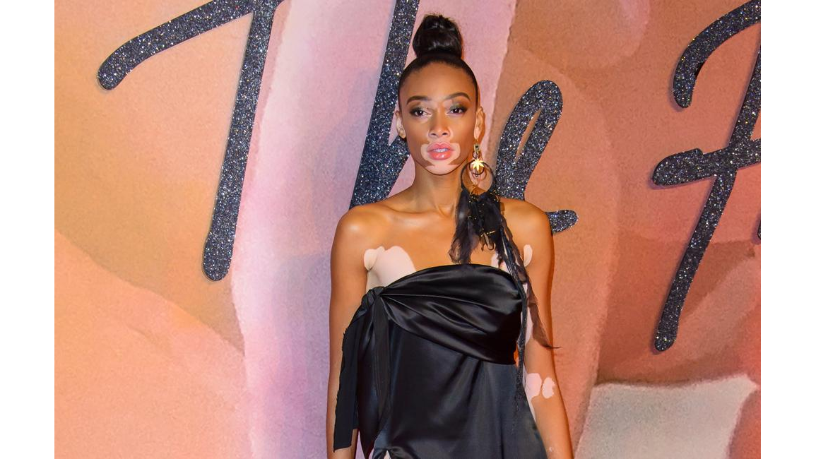 Winnie Harlow hopes to inspire would-be models - 8 Days