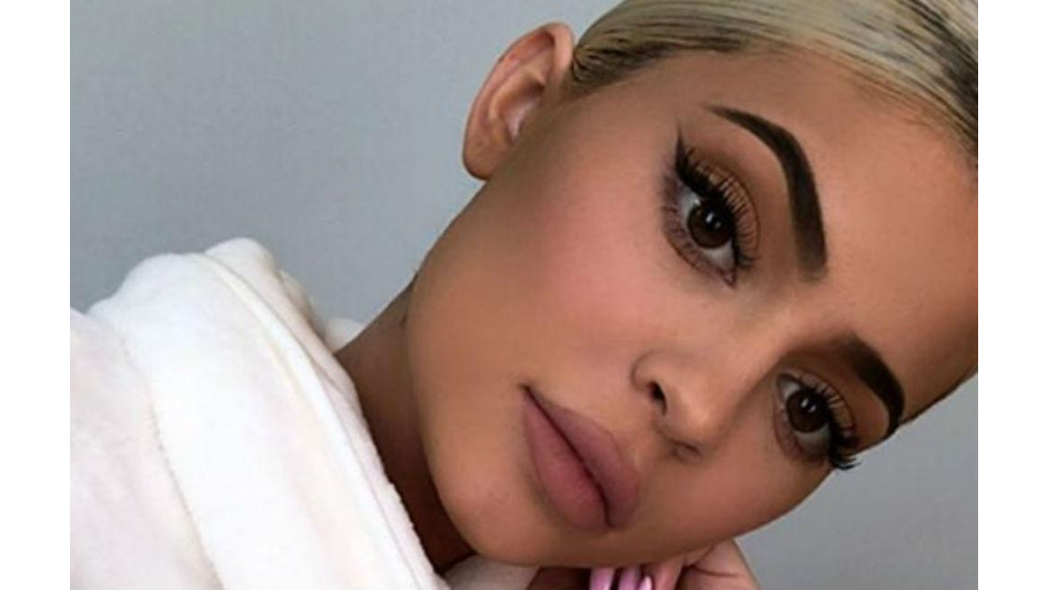 Kylie Jenner Gets Lip Fillers Back 8 Days