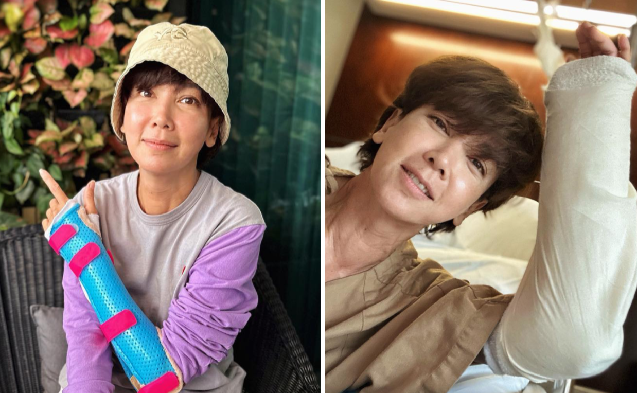 Kym Ng Was On MC The Past 5 Weeks; Broke Her Arm While Playing A Ghost In New Drama - 8days