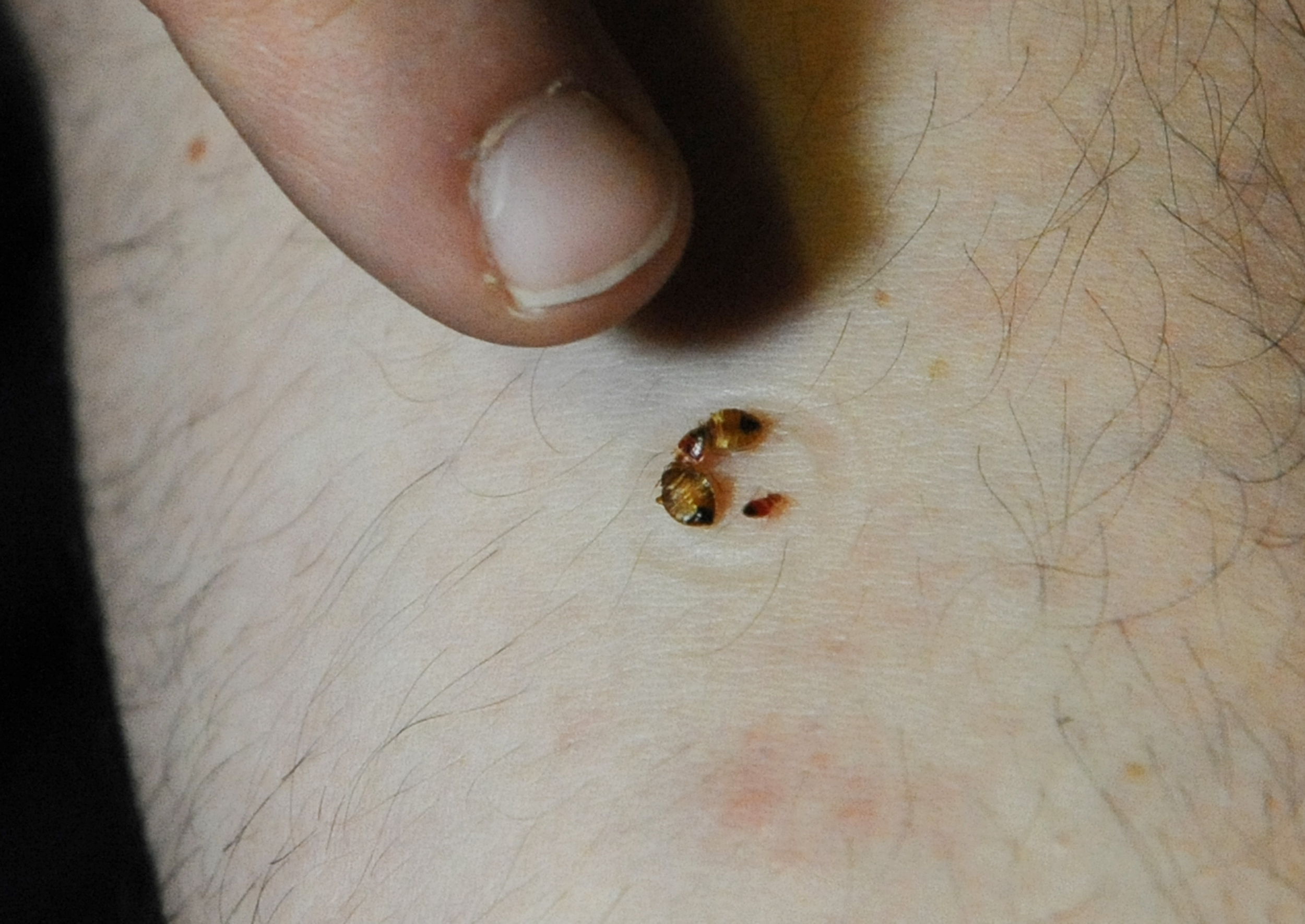 Bukan di tilam sahaja, pepijat pun boleh sembunyi di ruang lain di ...