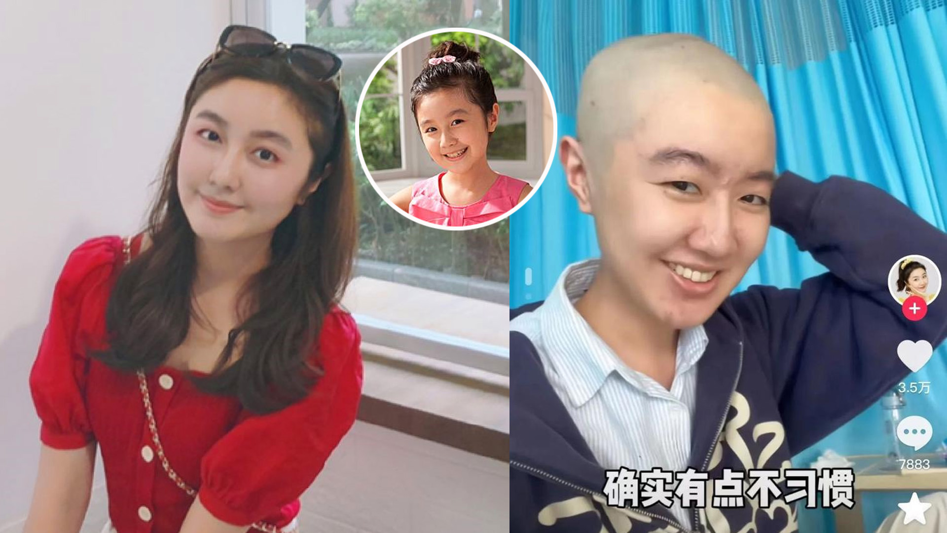 China’s “Most Popular Child Star”, Now 22, Undergoes Surgery For Brain ...