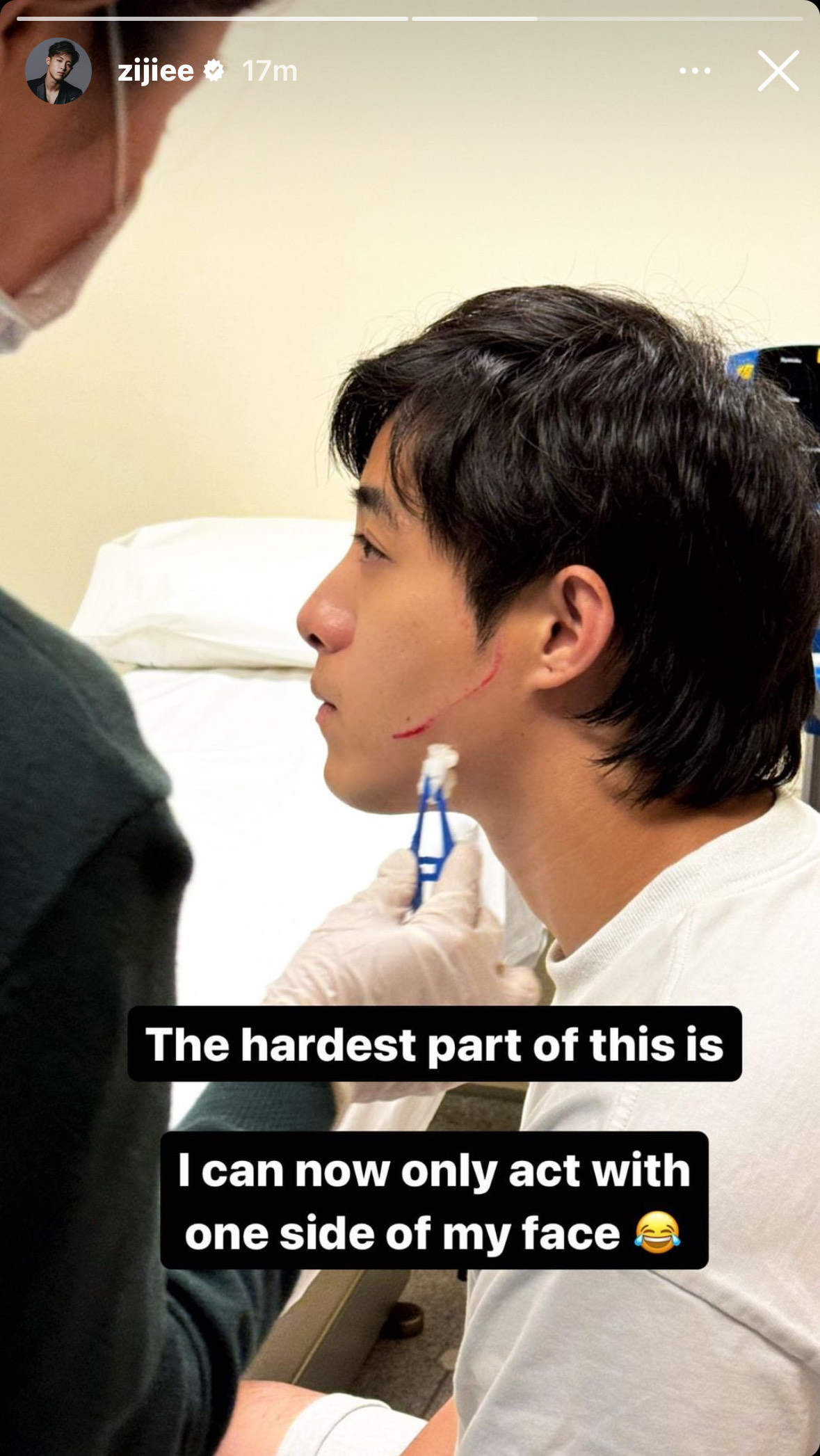 “I Think I Look Quite Badass Now”: Zong Zijie Gets 10cm Cut On His ...