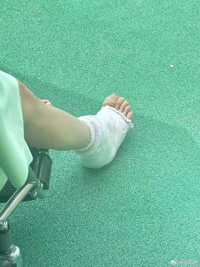Zhang Yuqi Lost An Entire Toe Nail Due To A Mishap While Wearing Heels ...